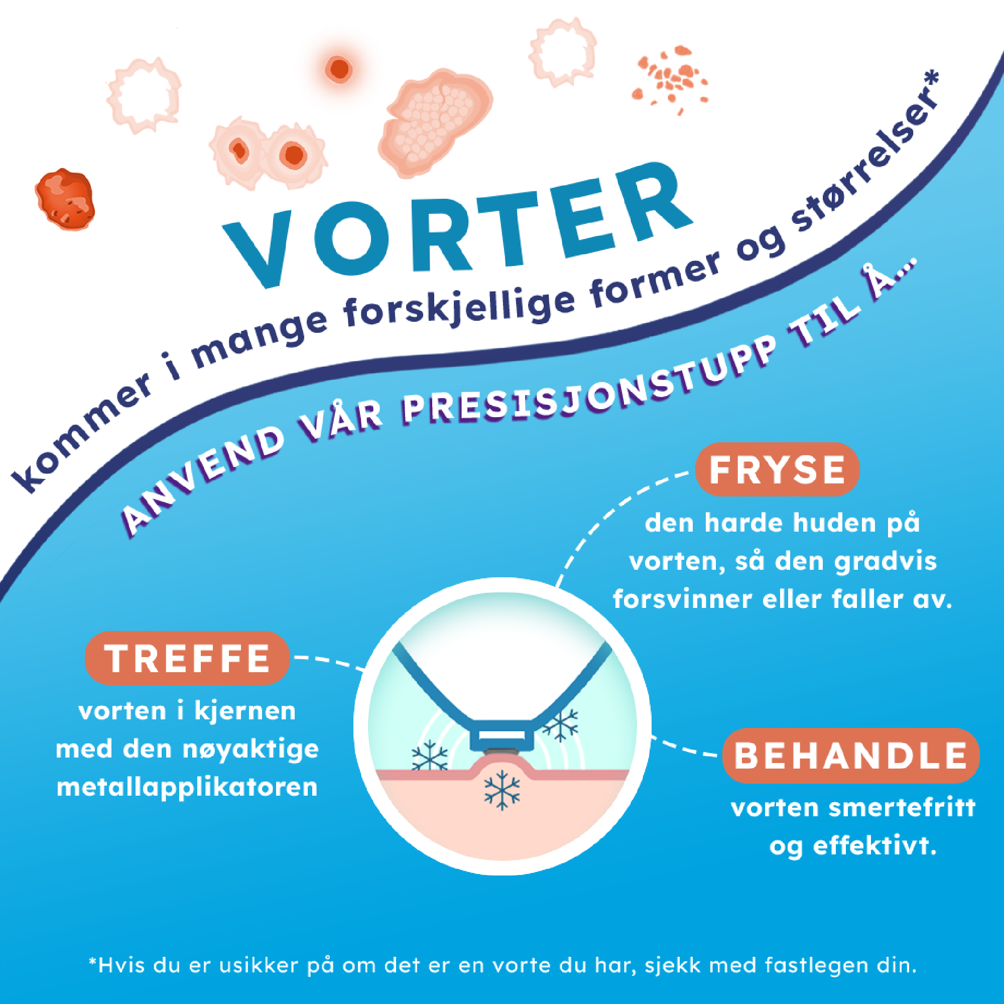 Wortie Freeze vortefjerner 50 ml - Apotek 1